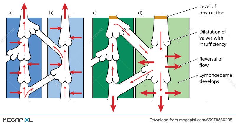 Backflow Clipart And Illustrations