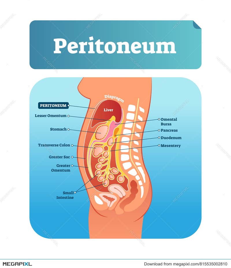 Intraperitoneal Clipart And Illustrations