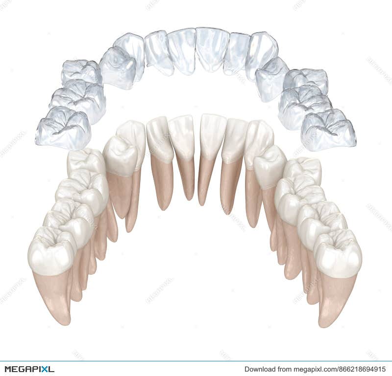 Deprogrammer Clipart And Illustrations