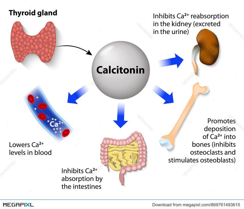 Hypercalcemia Clipart And Illustrations