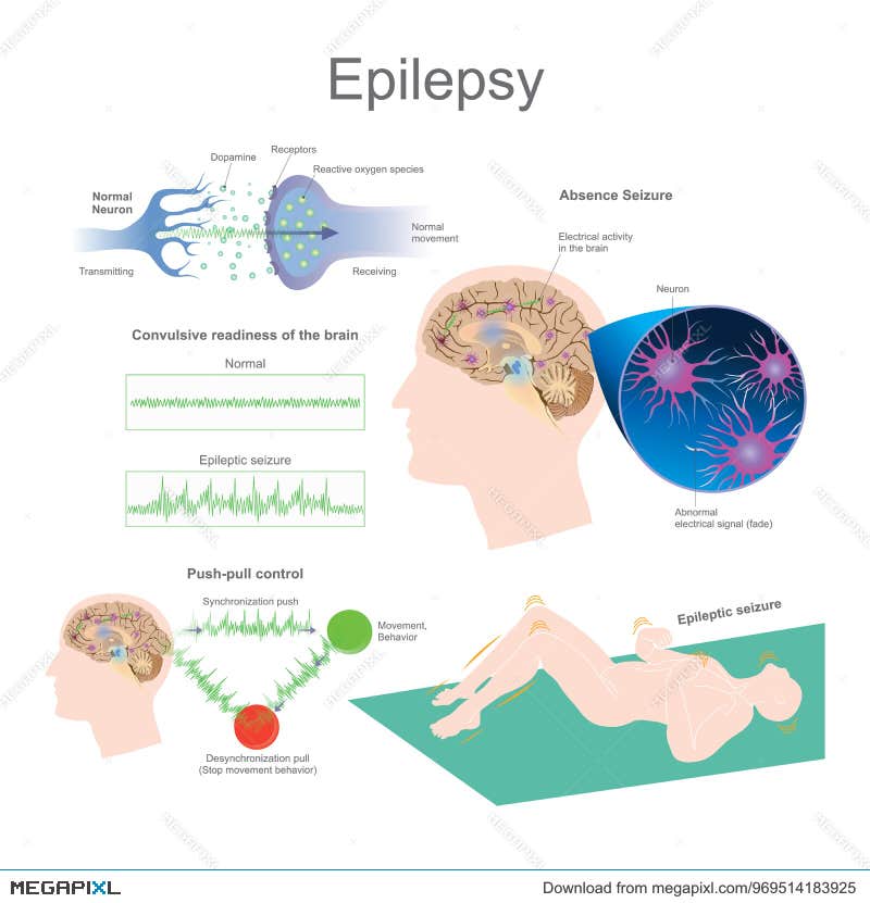 Desynchronization Clipart And Illustrations